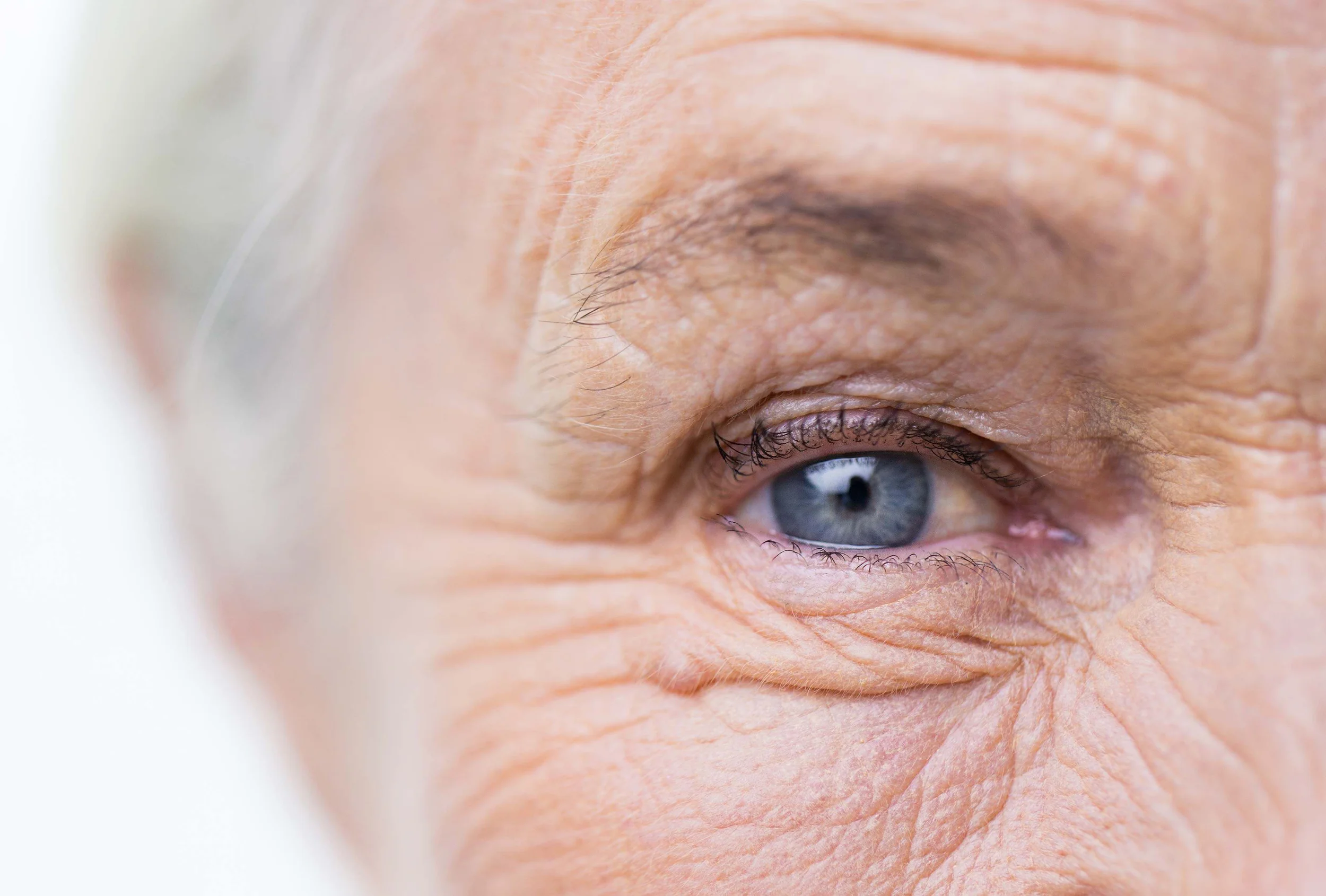 What happens to your skin as you age | The Skin Lab Medical Spa