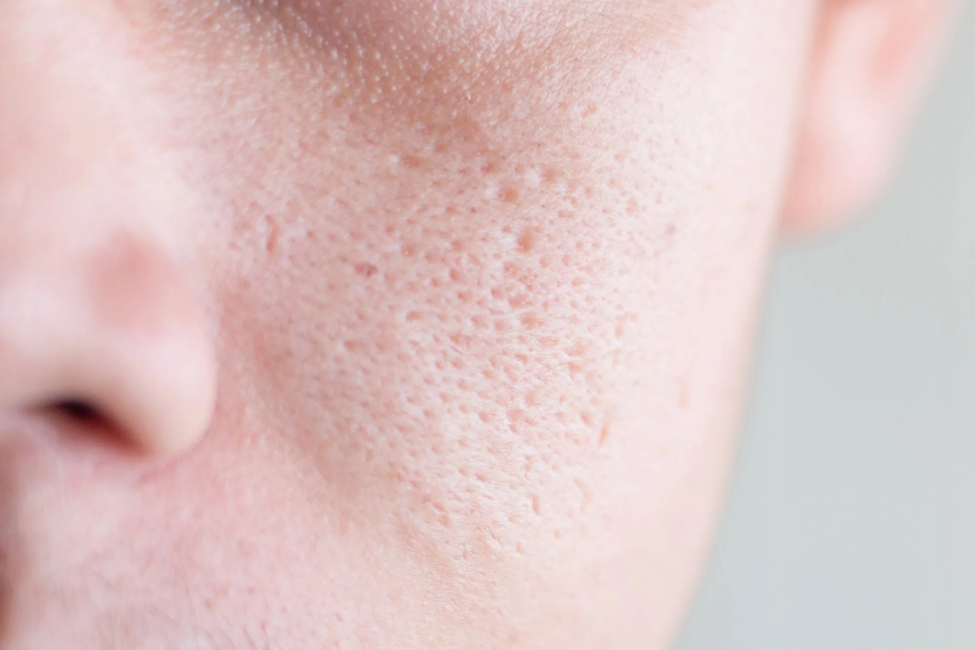 How To Minimize The Size Of Your Pores | The Skin Lab Medical Spa